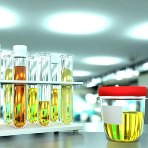 Urinary Tract Infection Panel (UTI) – St. Jude Labs